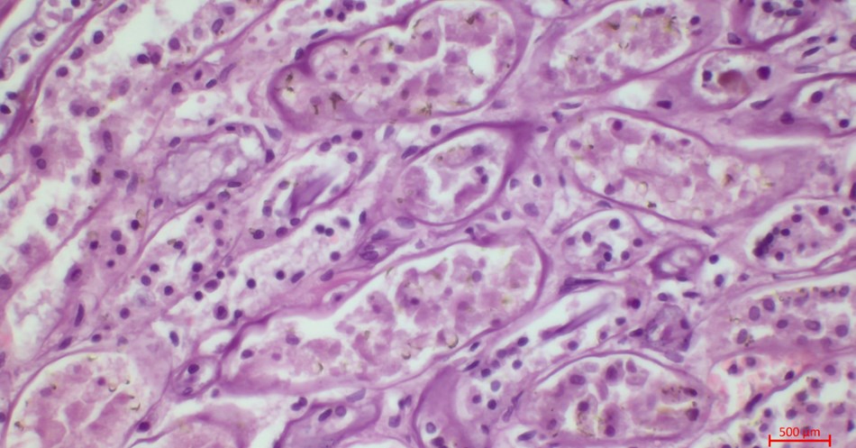 1MHZ TDI line scan camera for high-end optical inspection applications ...